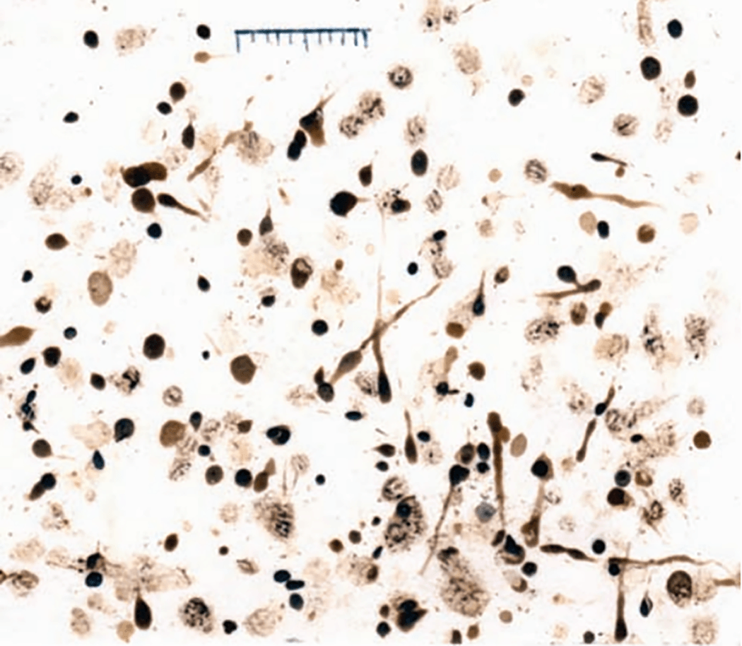Integrated Pest Management of Nonbiting Flies in Schools | OSU ...
